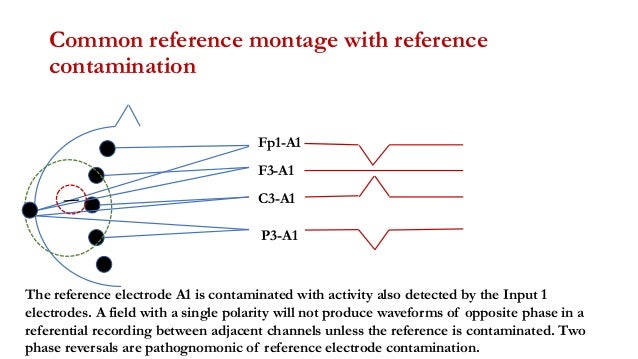 Principles of polarity in eeg