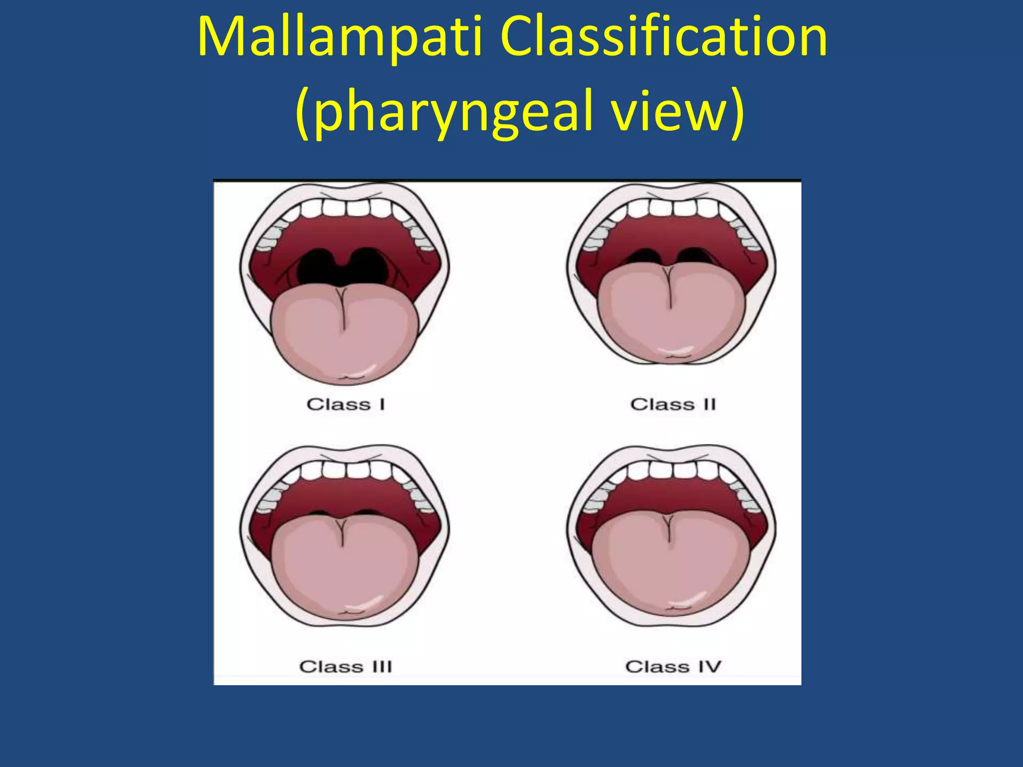 principles of preoperative evaluation and preparation.pptx | Lung and ...
