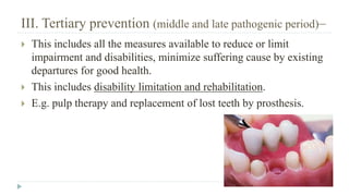 Principles of preventive dentistry | PPTX