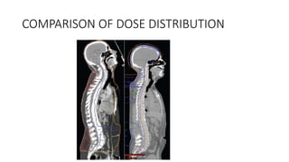 Principles of proton beam and cyberknife radiosurgery | PPTX