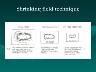 Principles of radiation oncology | PPT