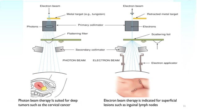 Principles of Radiation Therapy (July 2021) | PDF