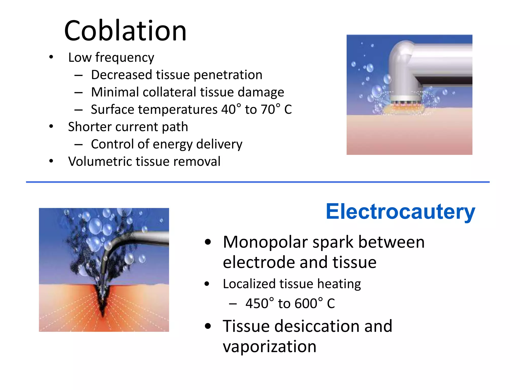 Principles Of Radiofrequency And Its ENT Applications | PPTX