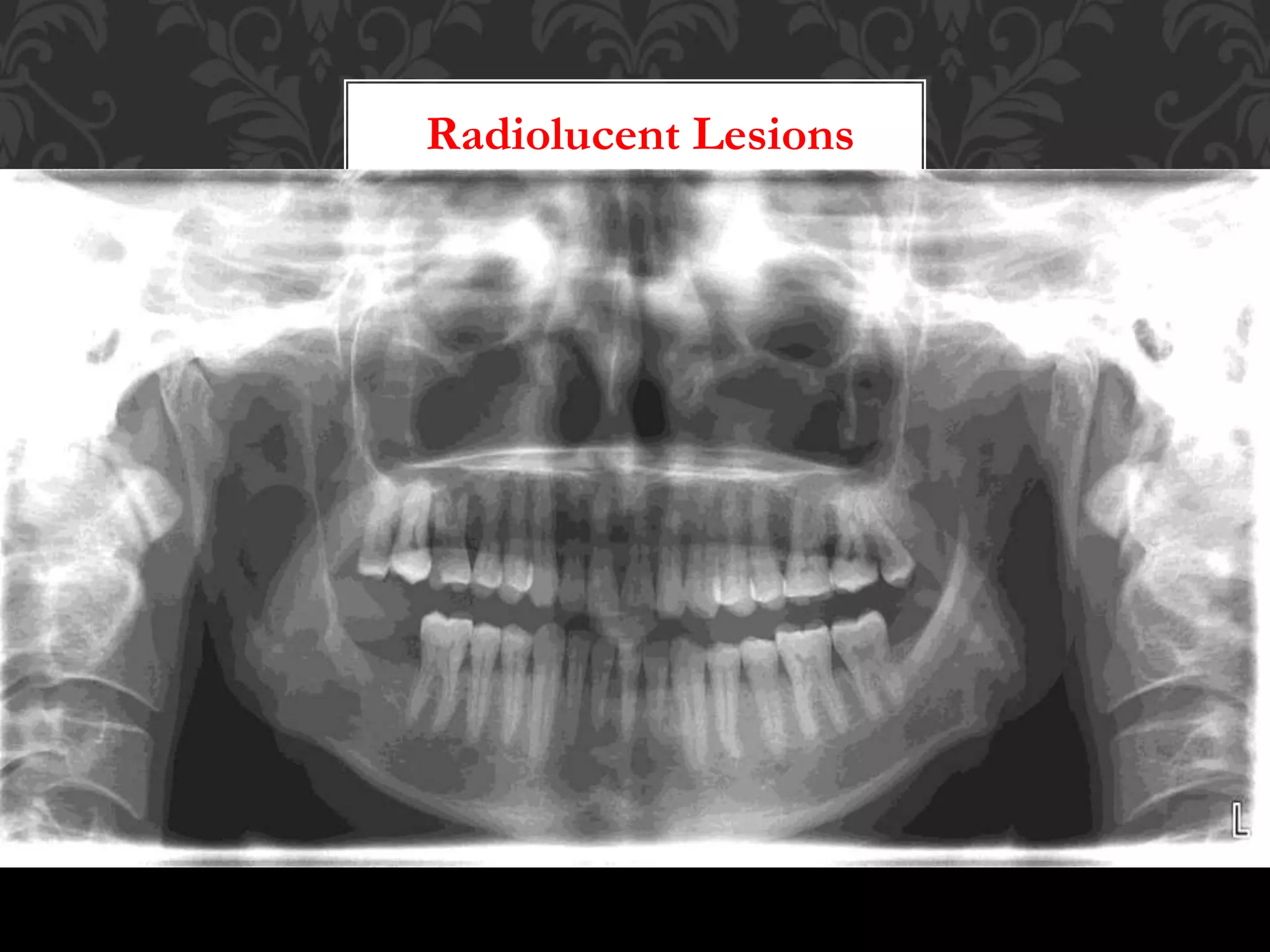 Principles of radiographic interpretation | PPTX