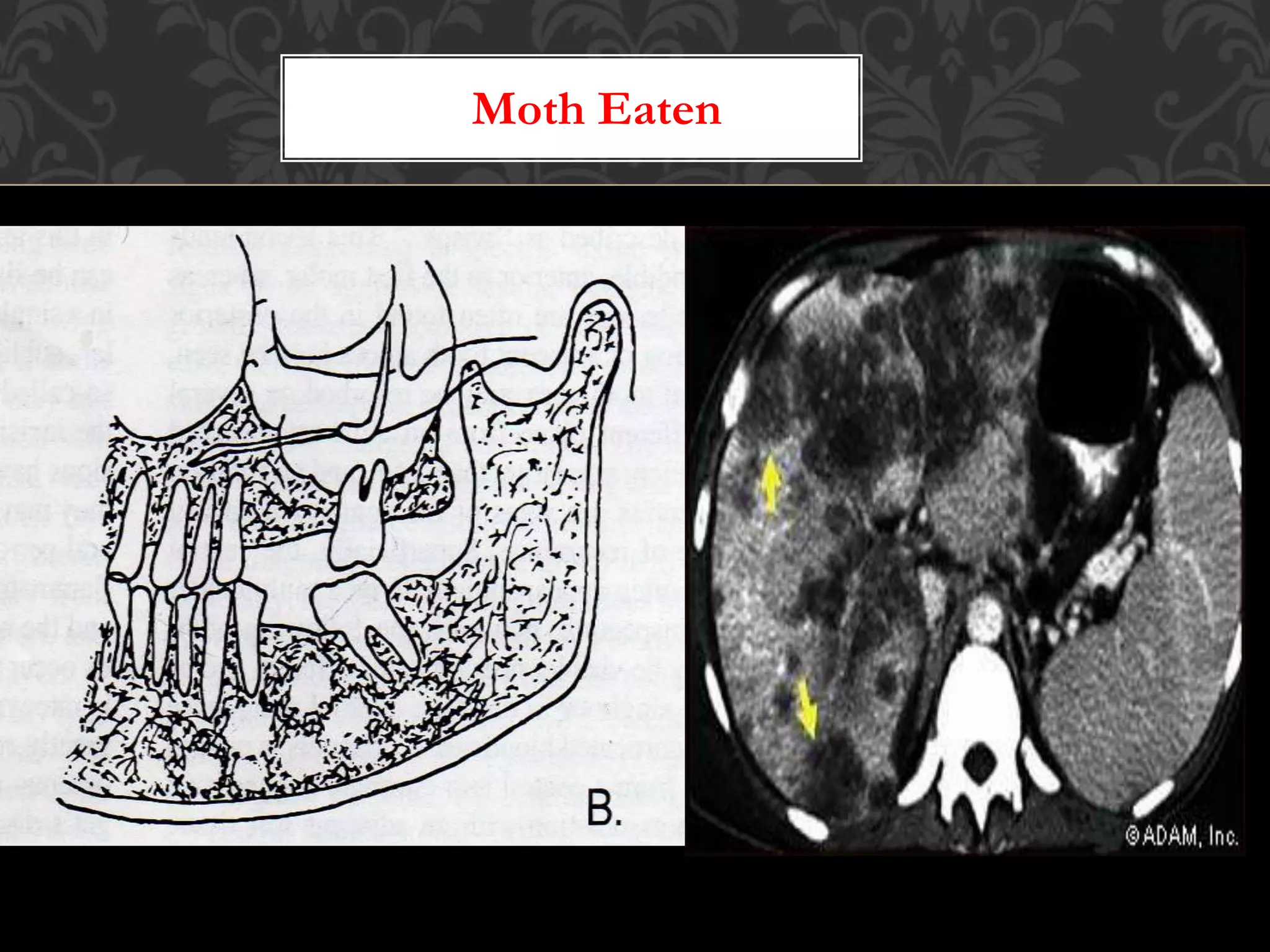 Principles of radiographic interpretation | PPTX