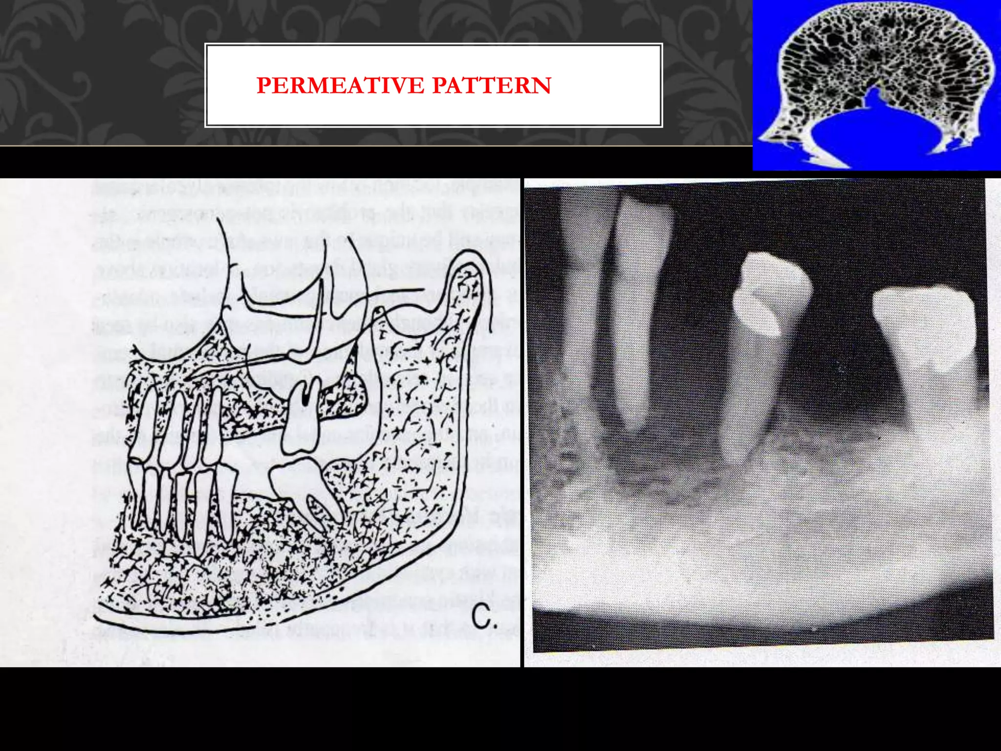 Principles of radiographic interpretation | PPTX