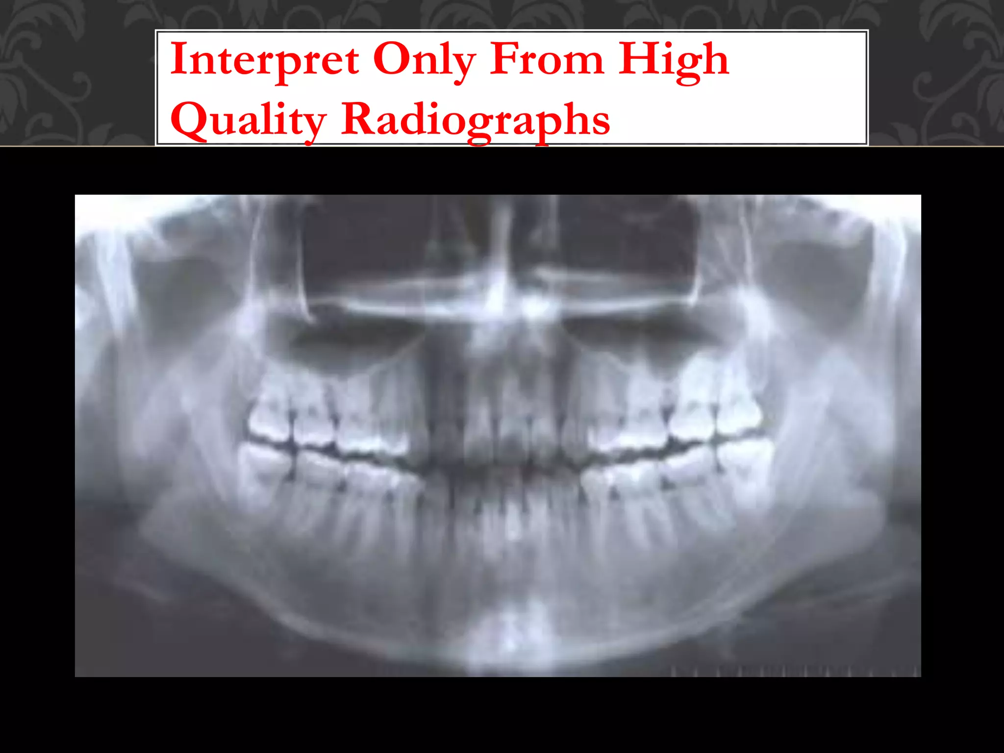 Principles of radiographic interpretation | PPTX