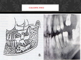 Principles of radiographic interpretation | PPTX