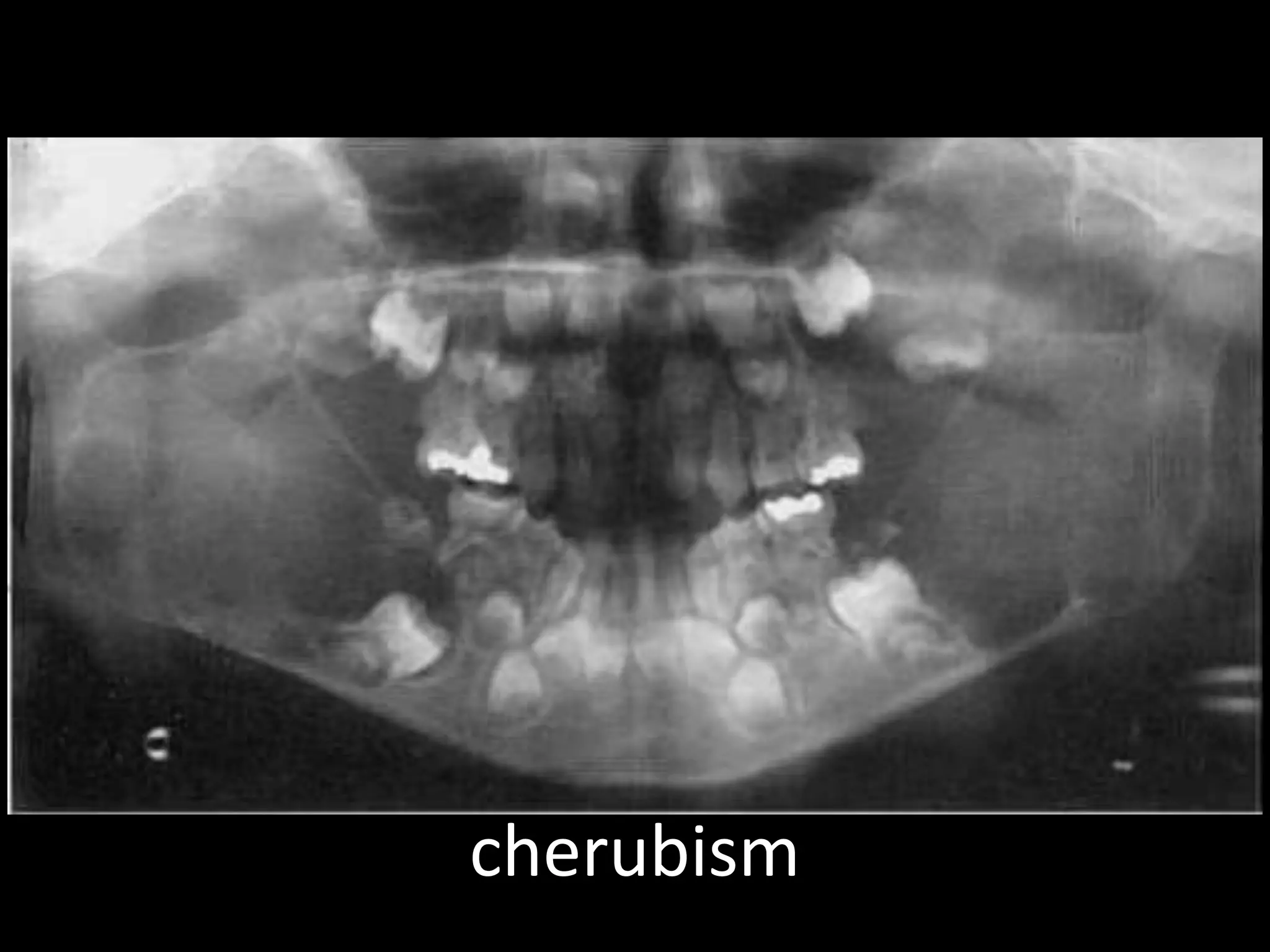 Principles of radiographic interpretations | PPTX