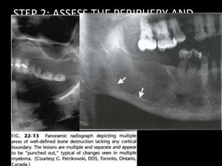 Principles of radiographic interpretations | PPTX