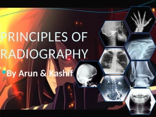 PRINCIPLES OF RADIOGRAPHY healthy physotherapy | PPTX