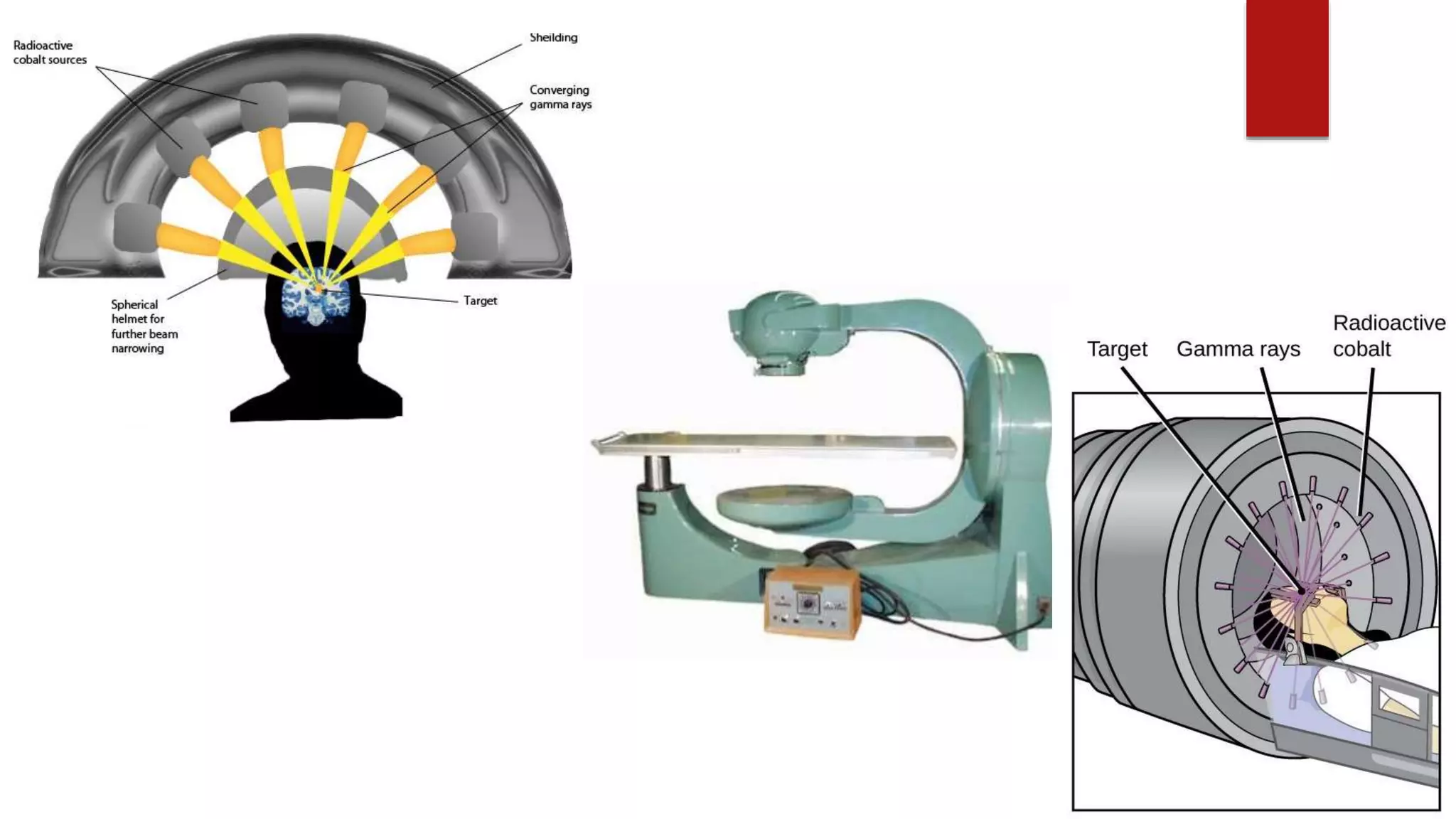 Principles of radiotherapy | PPTX
