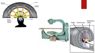 Principles of radiotherapy | PPTX