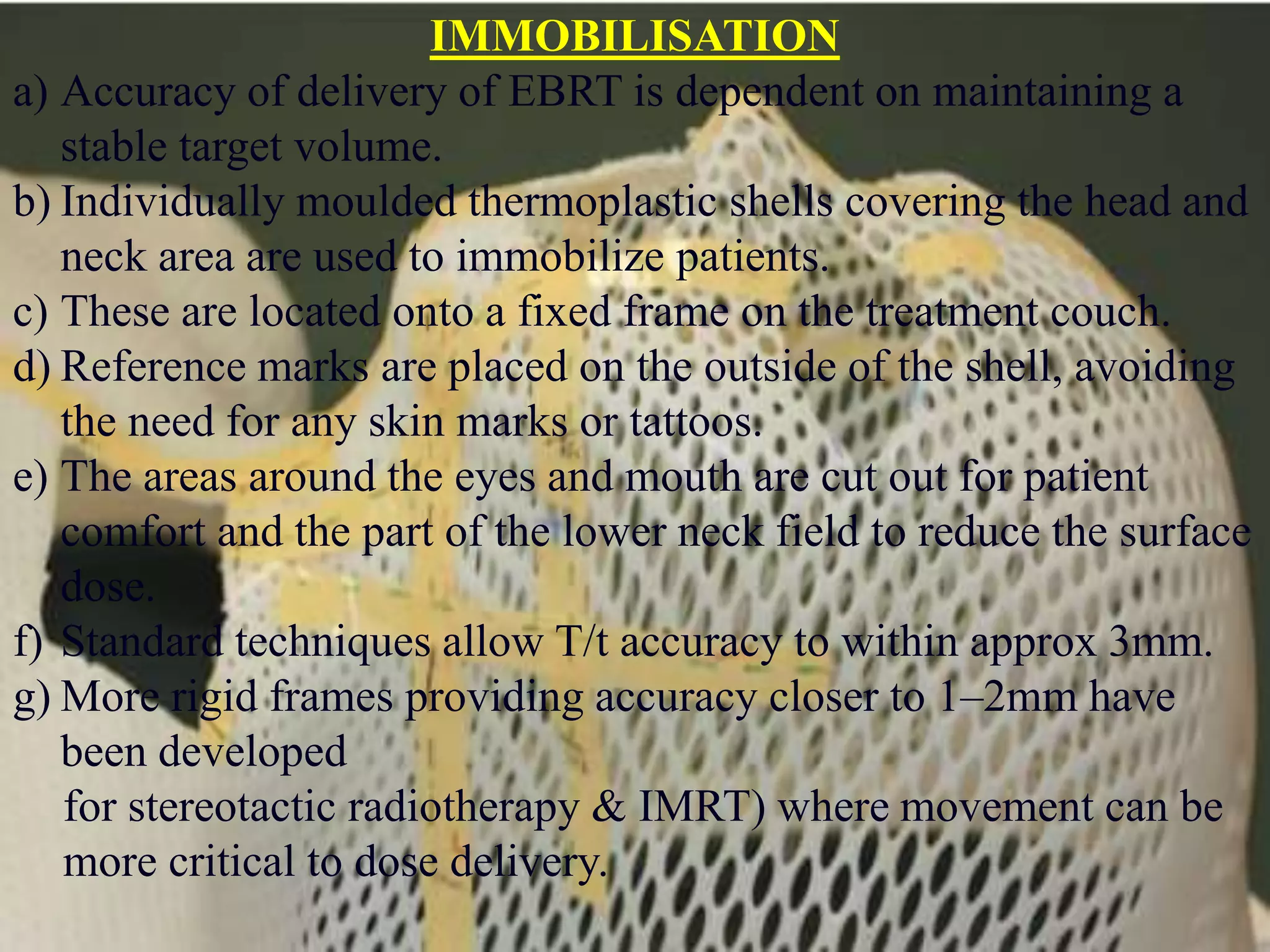 Principles of Radiotherapy in Head & Neck Surgery and Recent Advances A ...