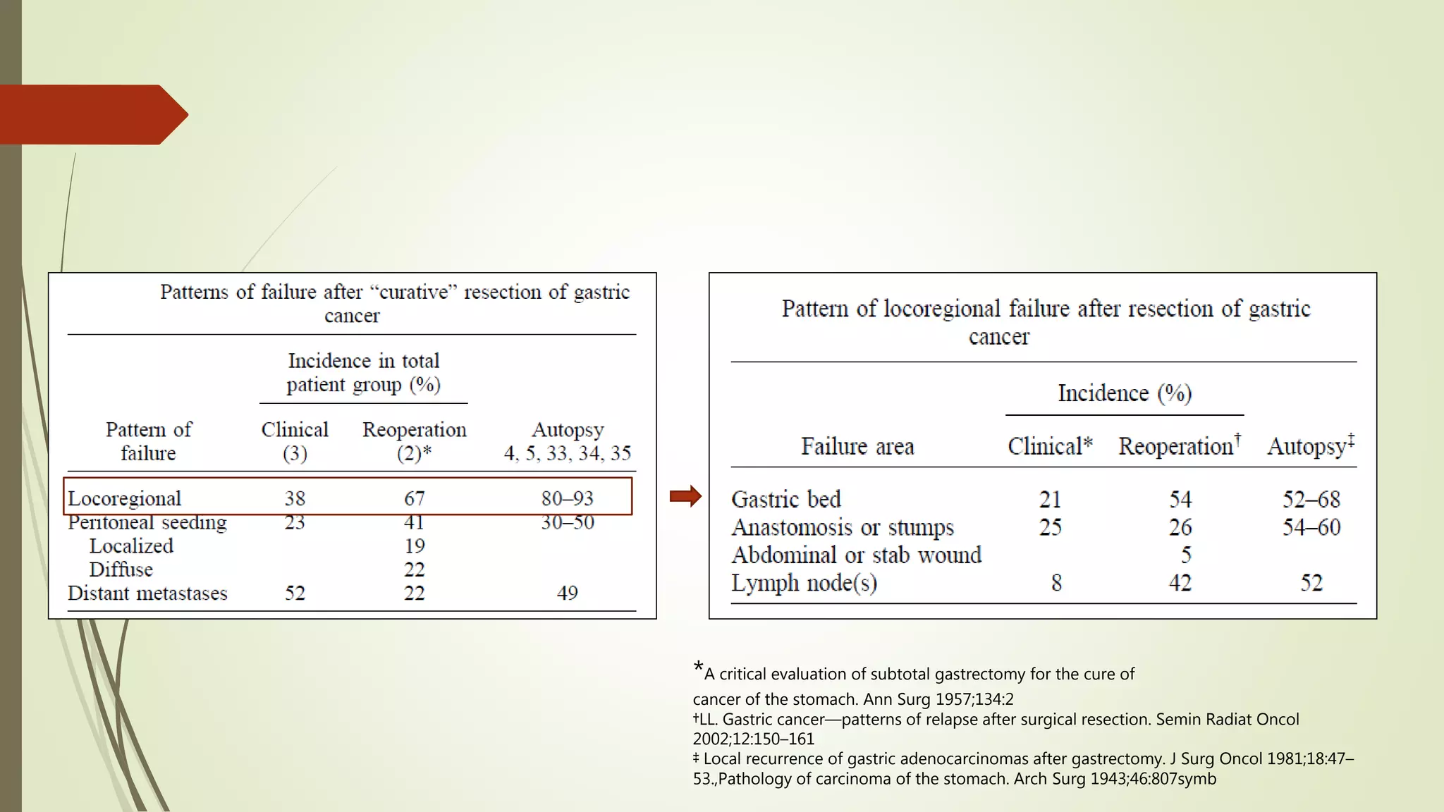 Principles of radiotherapy in gastric carcinoma | PPTX
