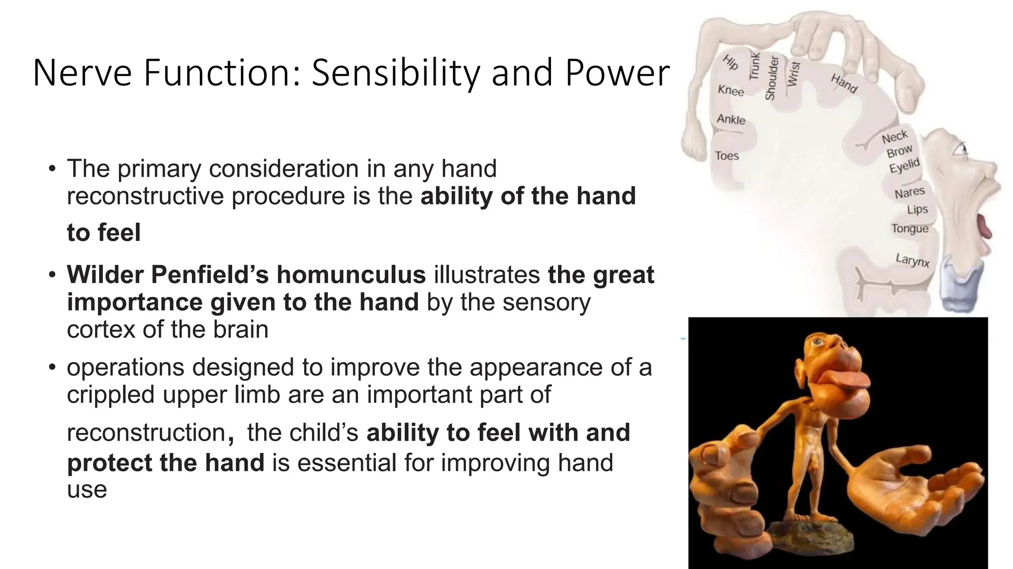 Principles of Reconstructions of Pediatric Hand.pptx