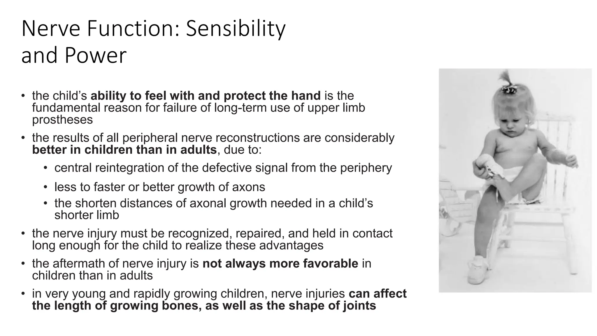 Principles of Reconstructions of Pediatric Hand.pptx