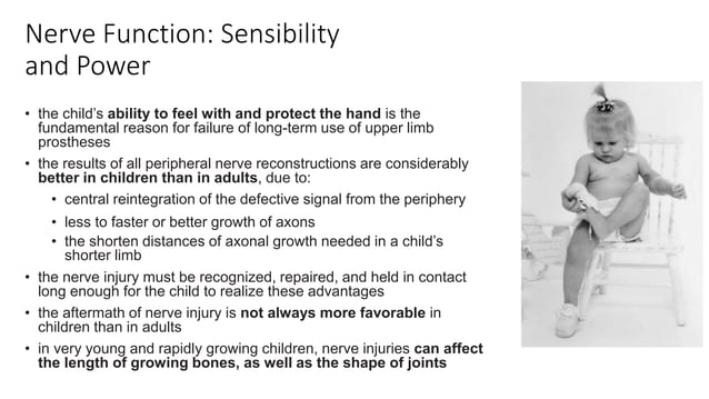 Principles of Reconstructions of Pediatric Hand.pptx