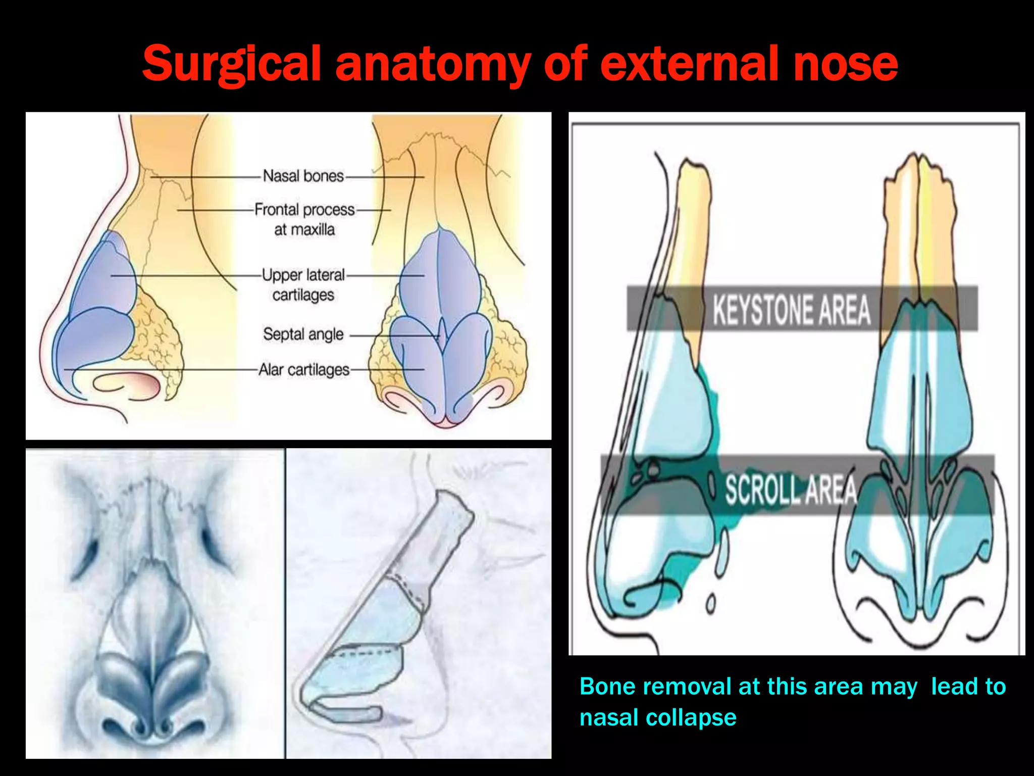 Principles of rhinoplasty | PPT