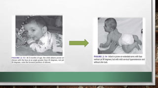 Principles of Roods Approach!!!!!!!.pptx