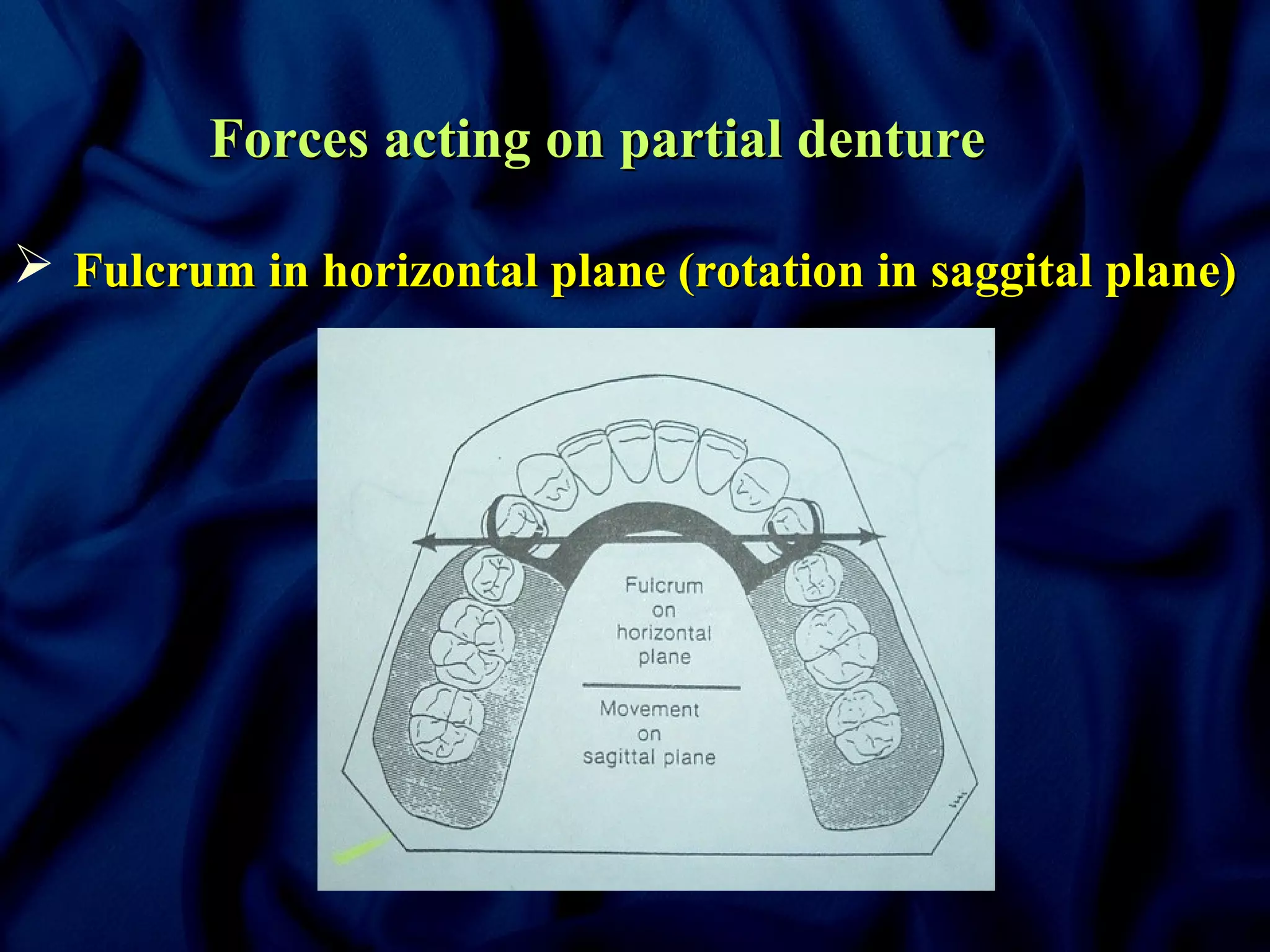 Principles of RPD by Dr. Anand Rajapur | PPT