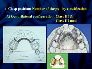 Principles of RPD by Dr. Anand Rajapur | PPT
