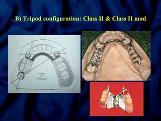 Principles of RPD by Dr. Anand Rajapur | PPT