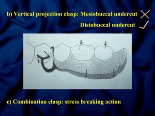 Principles of RPD by Dr. Anand Rajapur | PPT