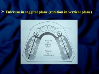 Principles of RPD by Dr. Anand Rajapur | PPT