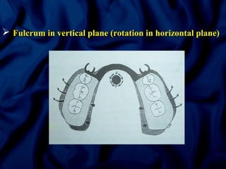 Principles of RPD by Dr. Anand Rajapur | PPT