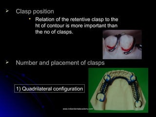 Principles of removable partial dentures / orthodontic seminars | PPT