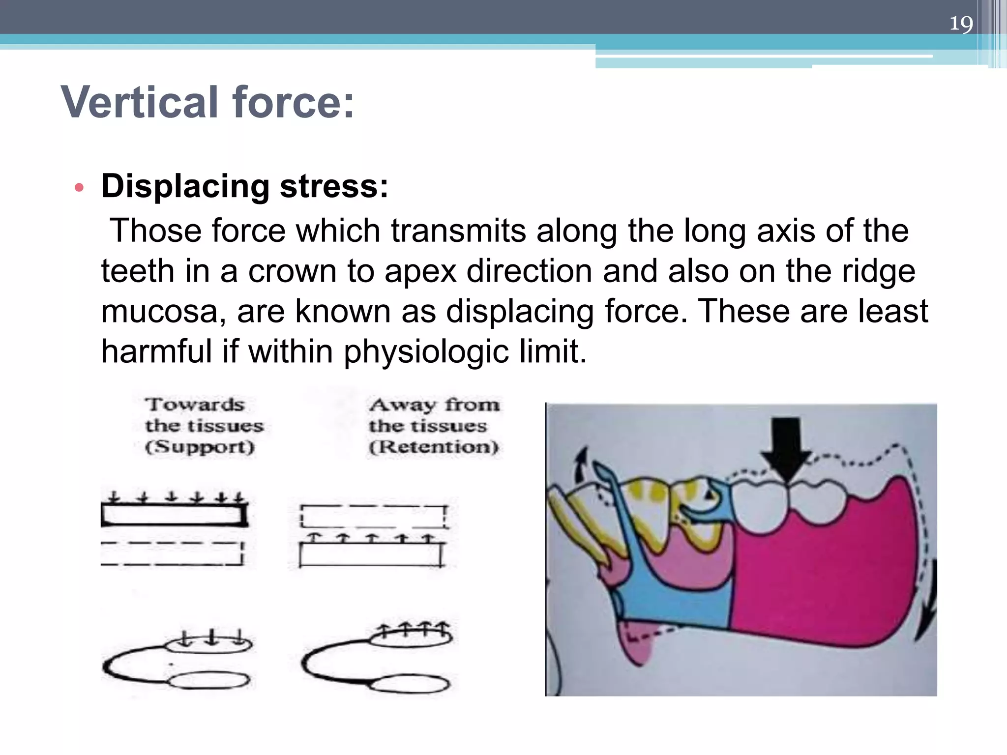 Principles of rpd design according to KENNEDY classification | PPTX