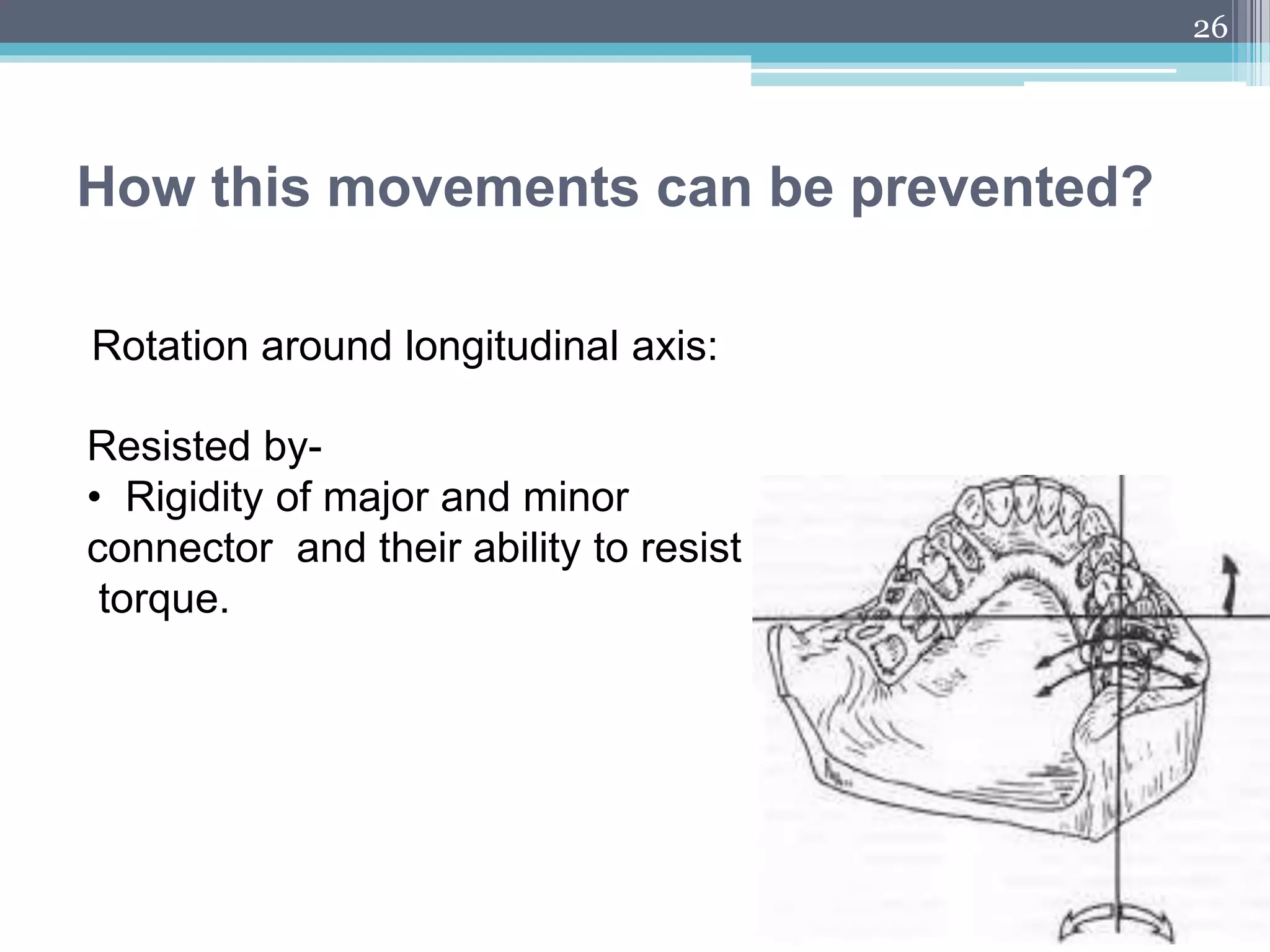 Principles of rpd design according to KENNEDY classification | PPTX