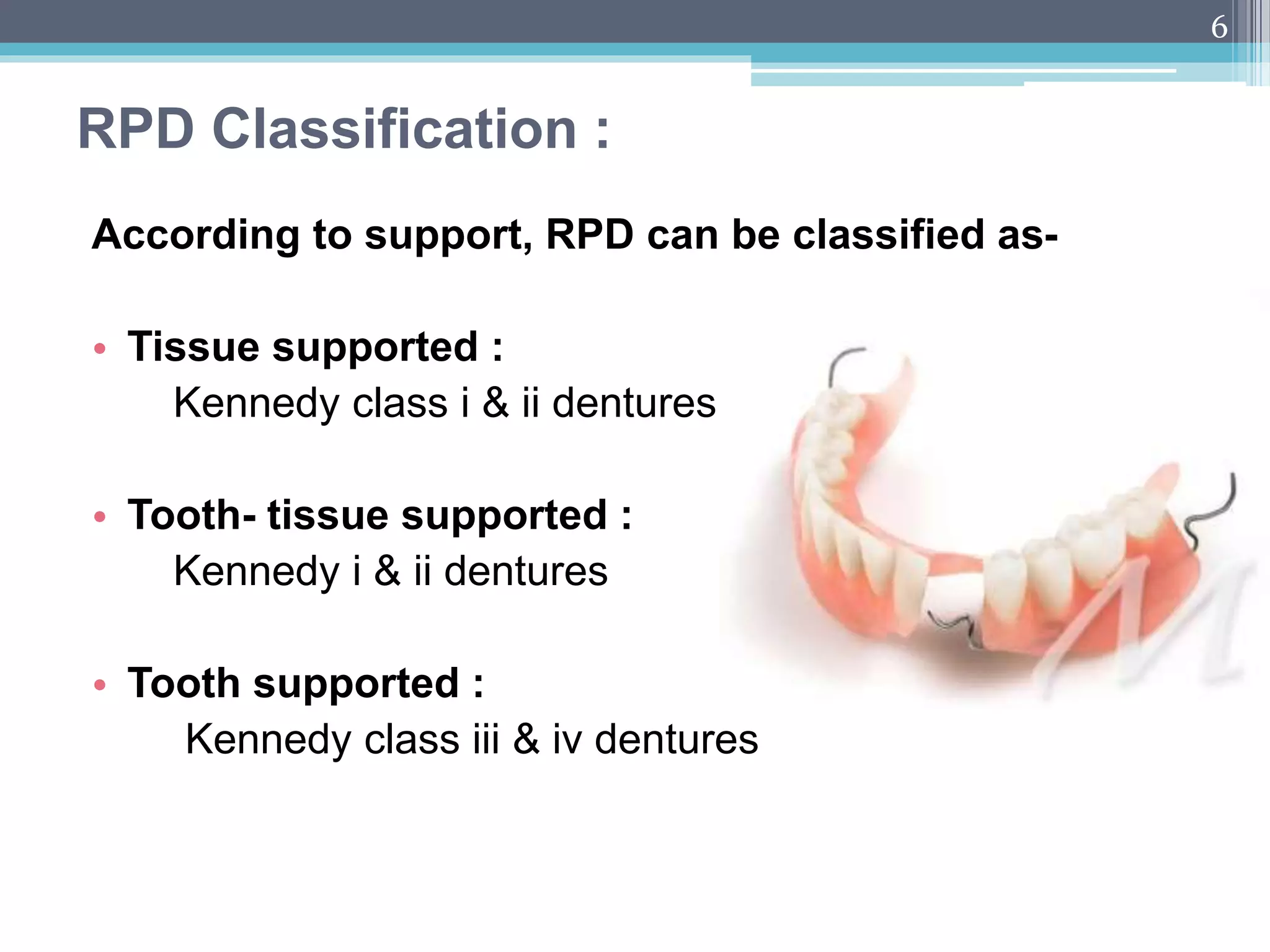 Principles of rpd design according to KENNEDY classification | PPTX