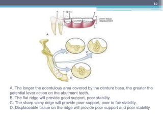 Principles of rpd design according to KENNEDY classification | PPTX