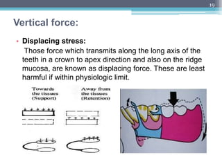 Principles of rpd design according to KENNEDY classification | PPTX