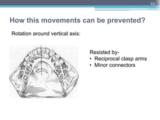 Principles of rpd design according to KENNEDY classification | PPTX