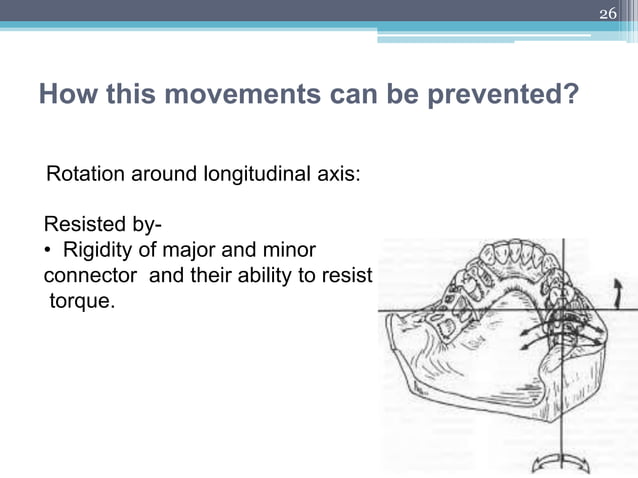 Principles of rpd design according to KENNEDY classification | PPTX