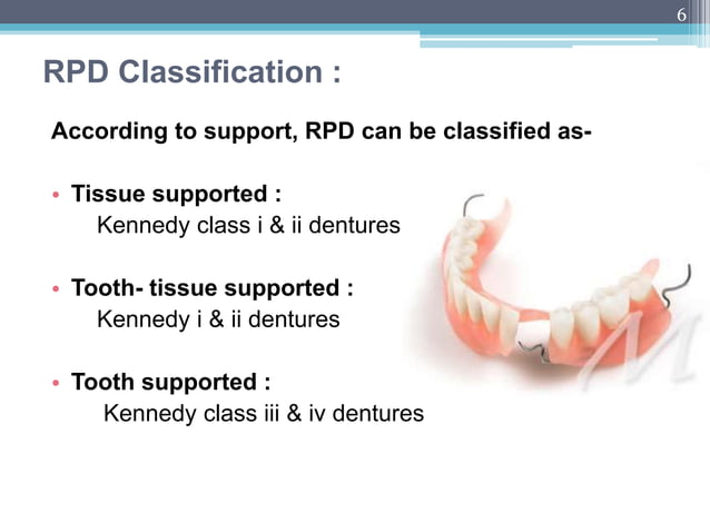 Principles of rpd design according to KENNEDY classification | PPTX