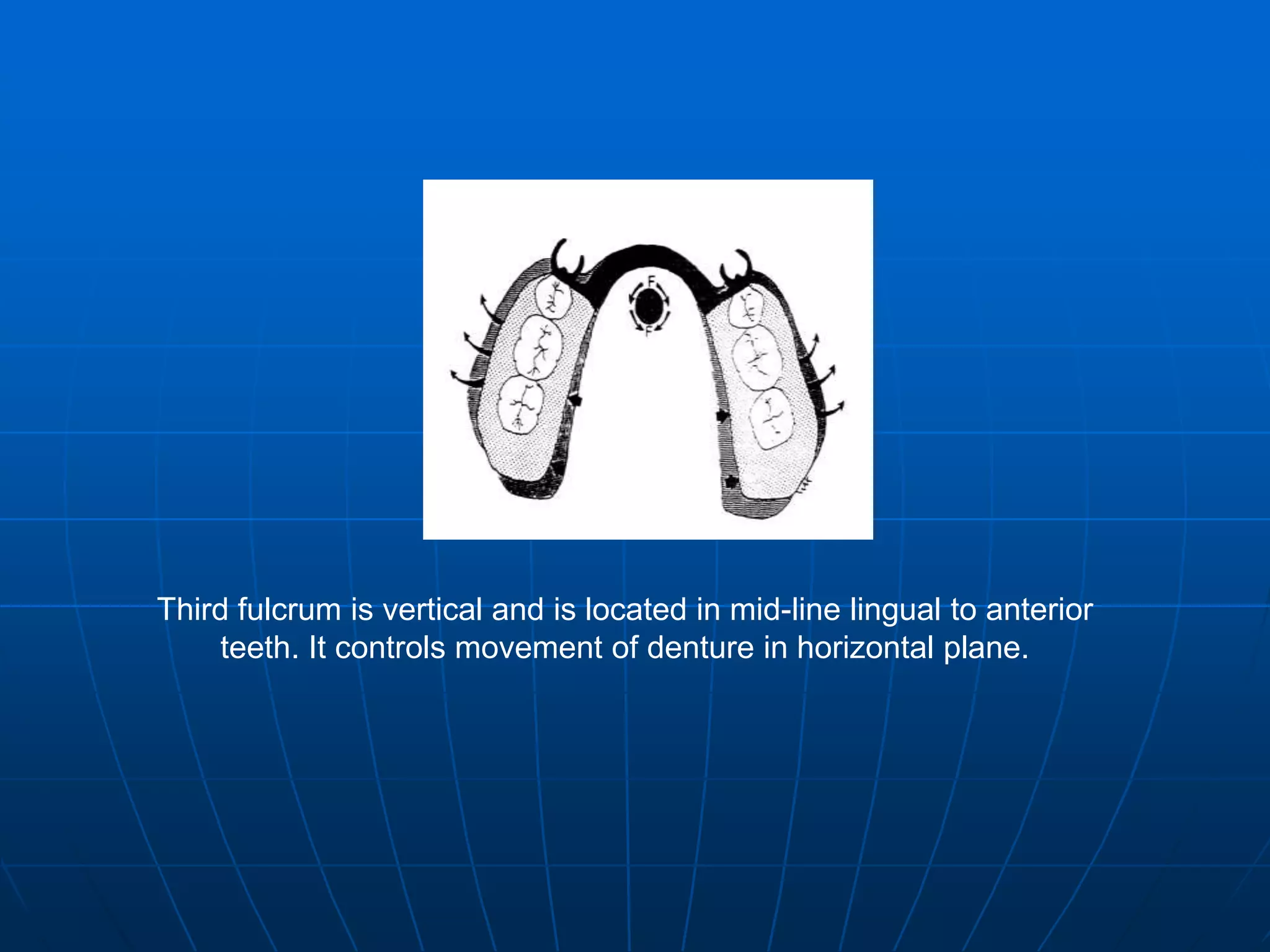 Principles of rpd design | PPT