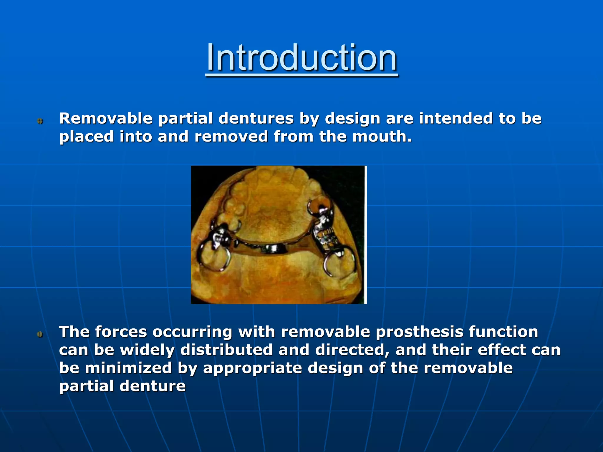 Principles of rpd design | PPT