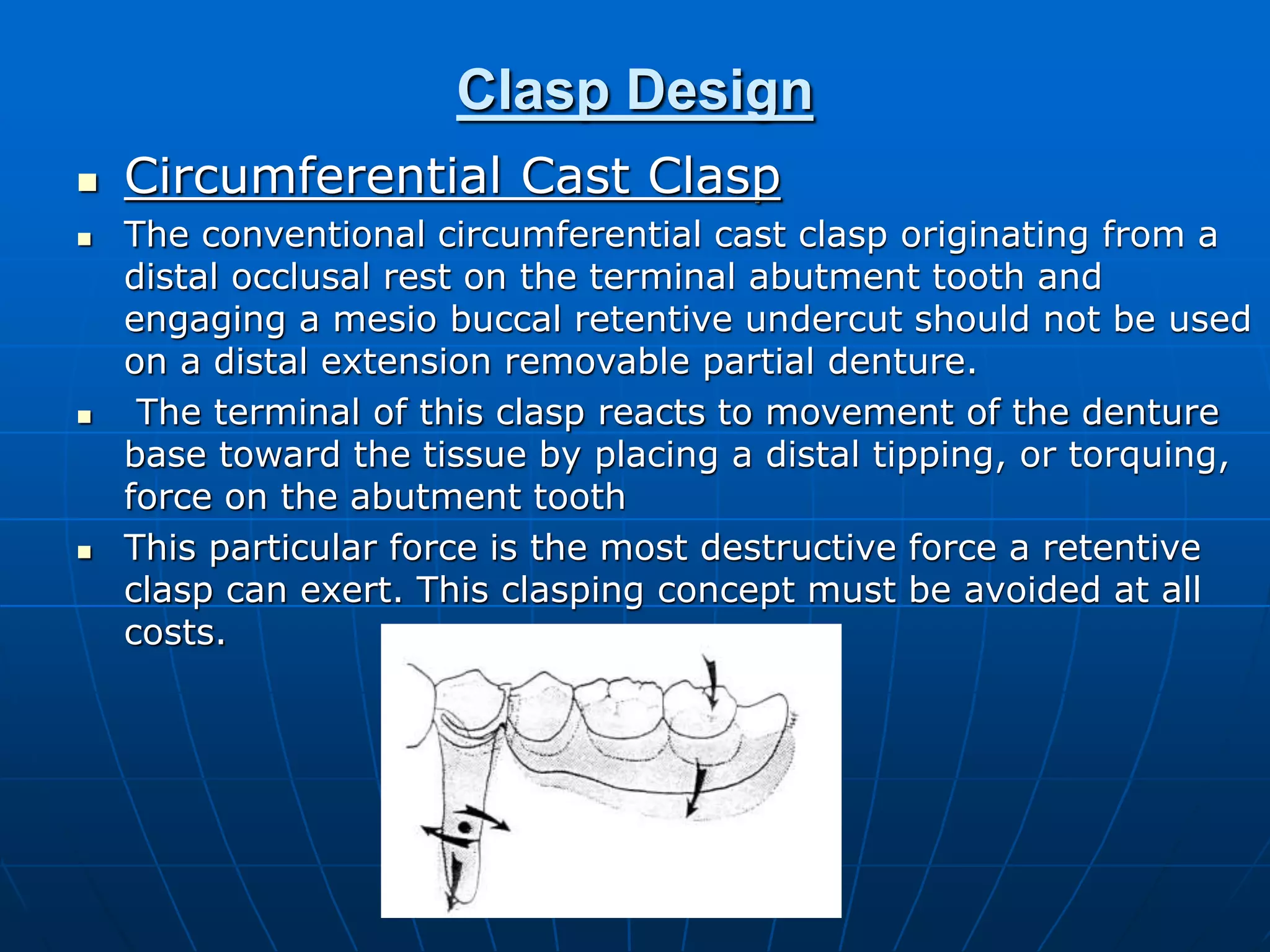 Principles of rpd design | PPT