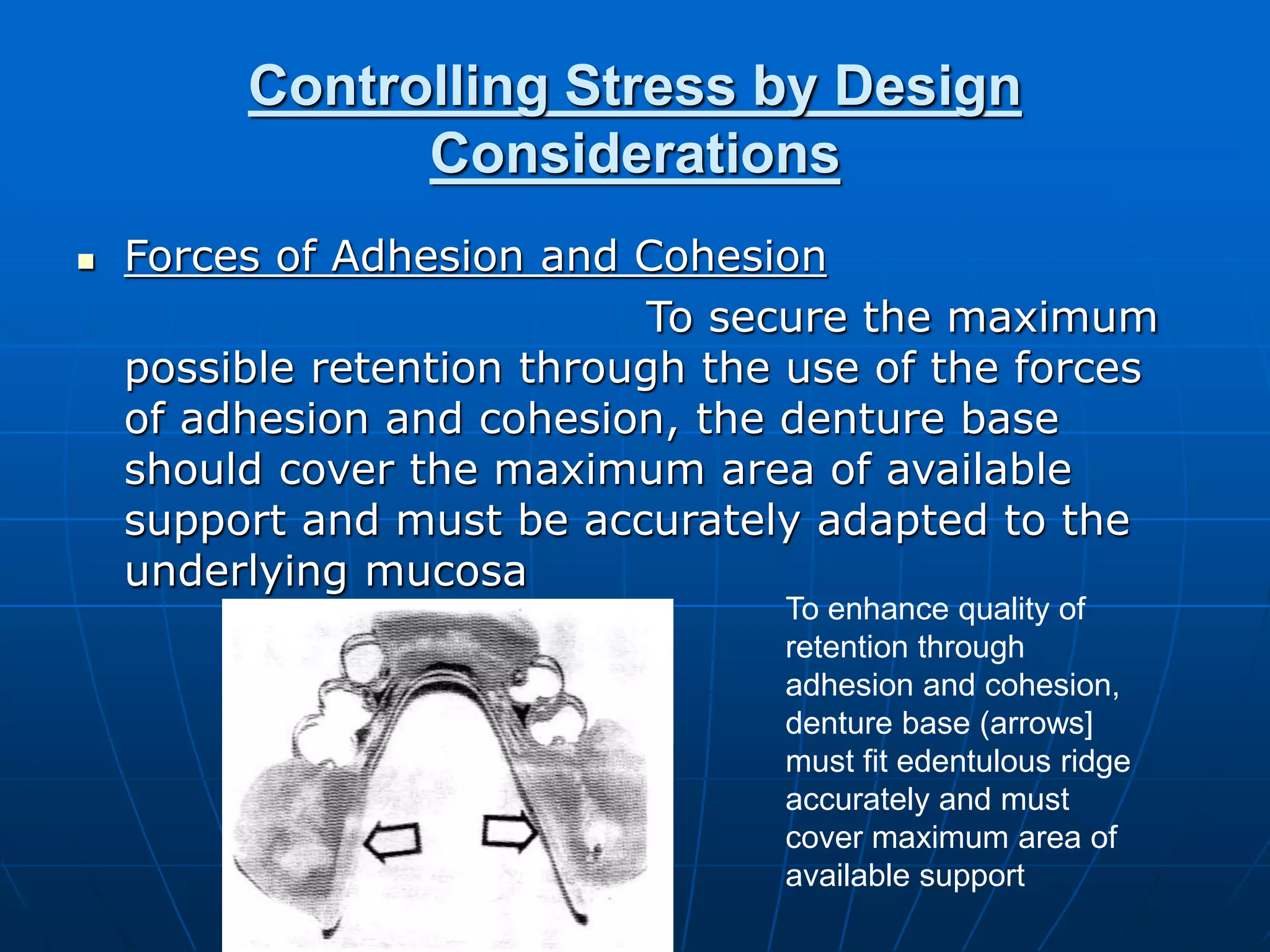 Principles of rpd design | PPT