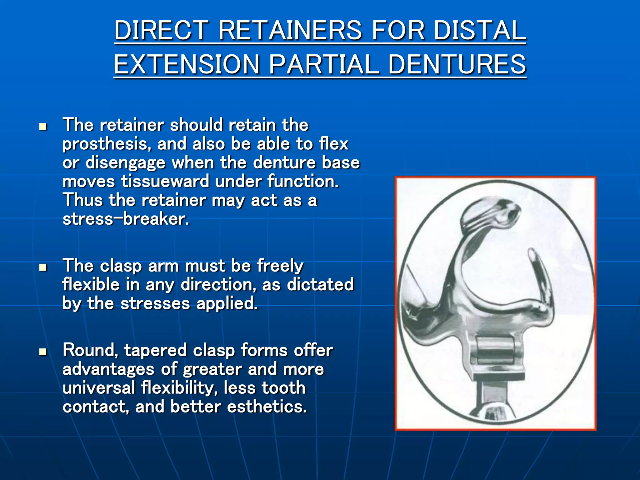 Principles of rpd design | PPT