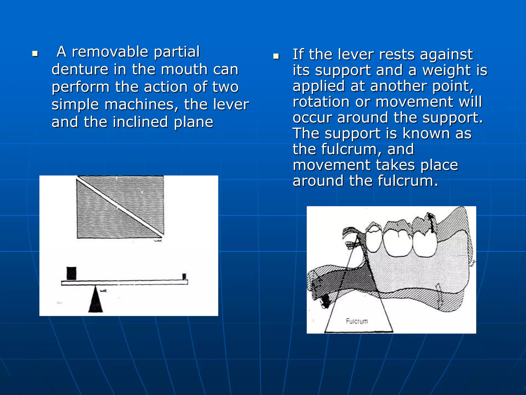 Principles of rpd design | PPT