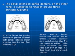 Principles of rpd design | PPT
