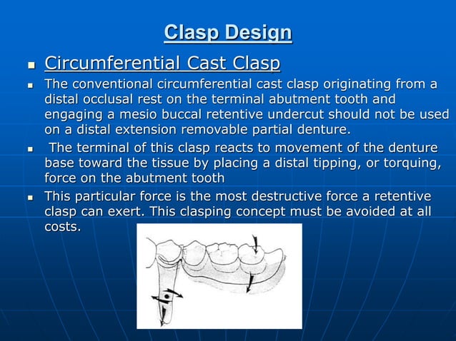 Principles of rpd design | PPT