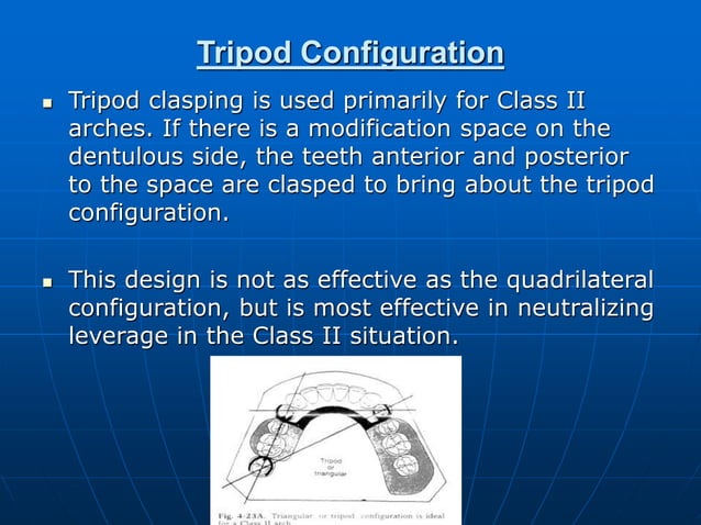 Principles of rpd design | PPT