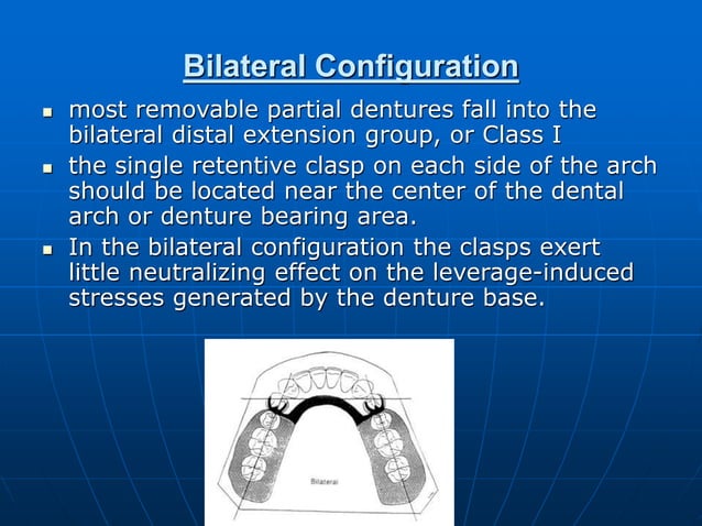 Principles of rpd design | PPT