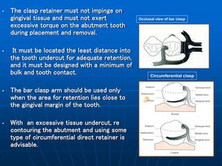 Principles of rpd design | PPT